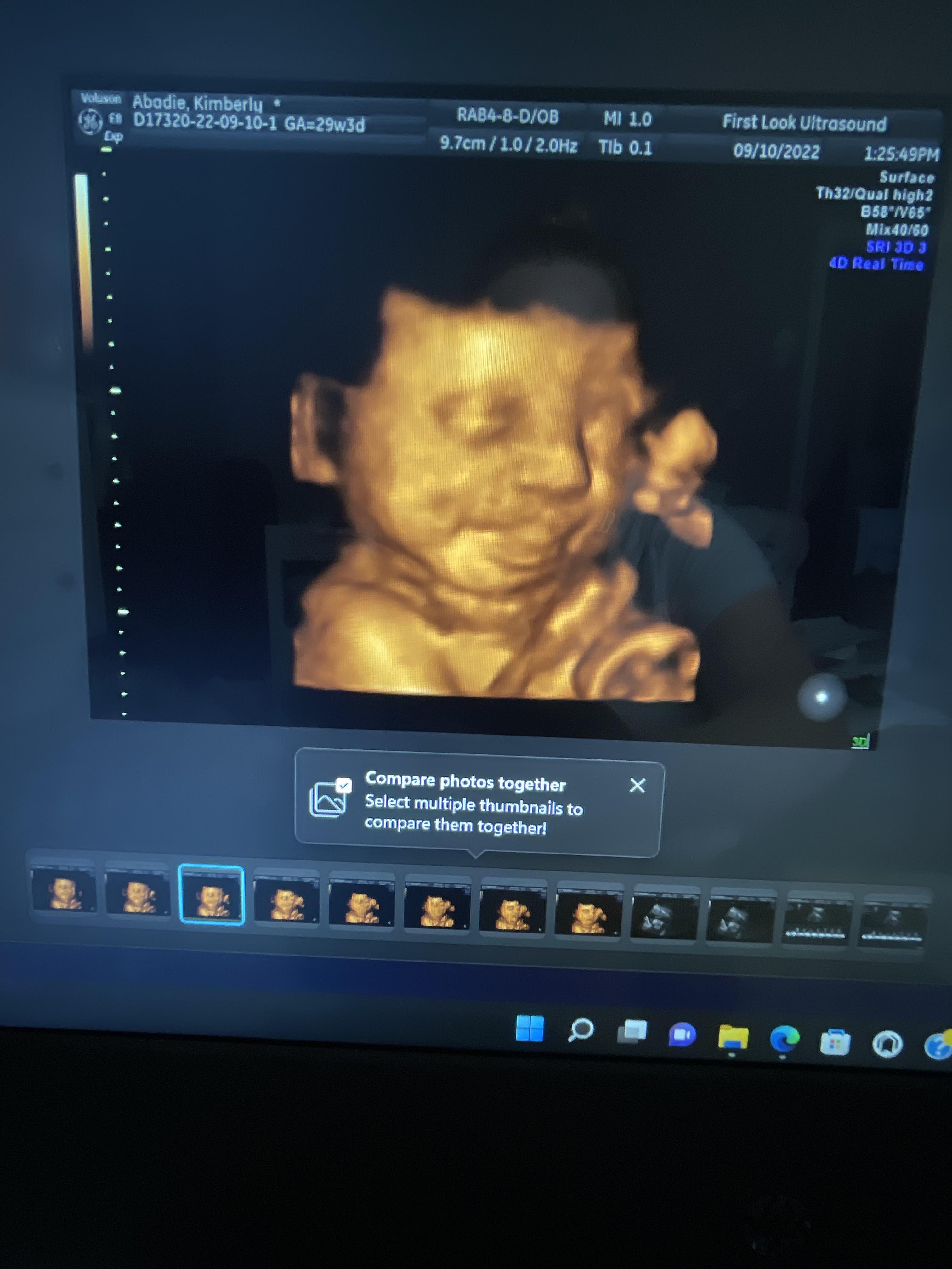 4d Ultrasound 29 Weeks